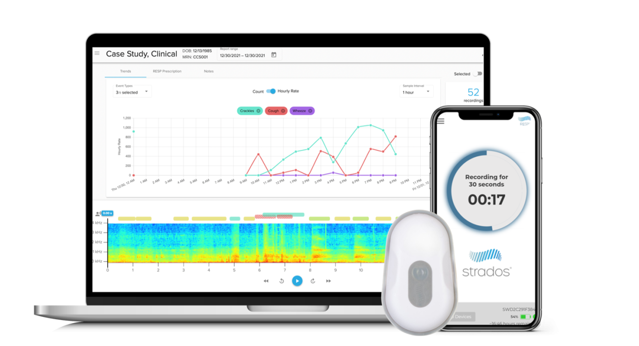 Remote Stethoscope for Telemedicine - Digital, Virtual and Wearable