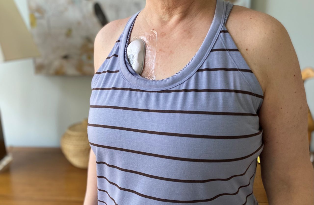 COPD Remote Patient Monitoring: Overview & New Technologies