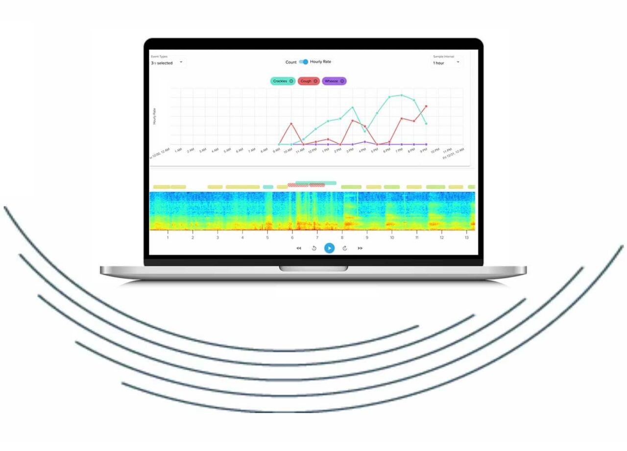 Strados Labs | Wearable Stethoscope & Respiratory Monitor